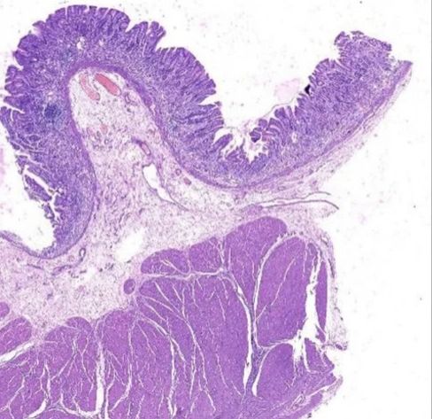 Stomach Pylorus Histology Prepared Slide - Manufacturer Exporter ...